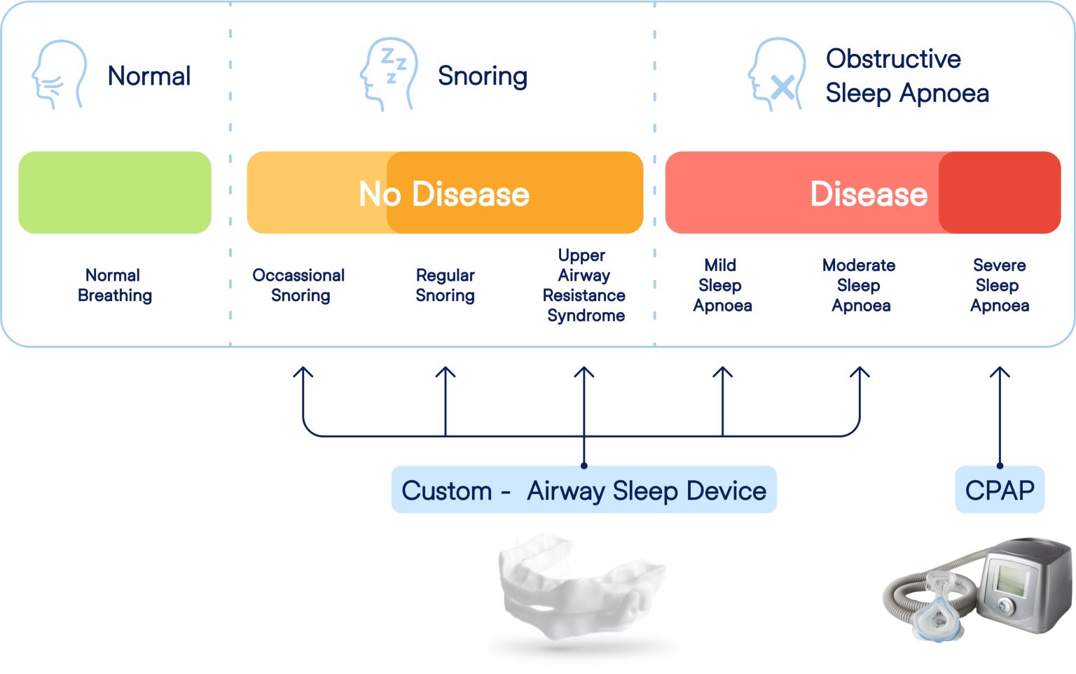 Dental Sleep Treatment | Custom Airway Sleep Devices | MAS